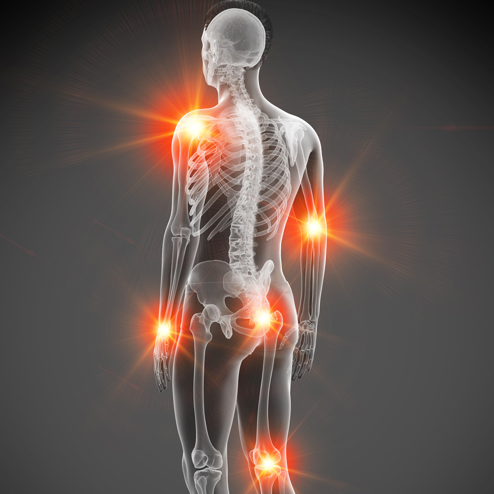 Joint Pain Affects Millions - Power Relief® Pain Cream